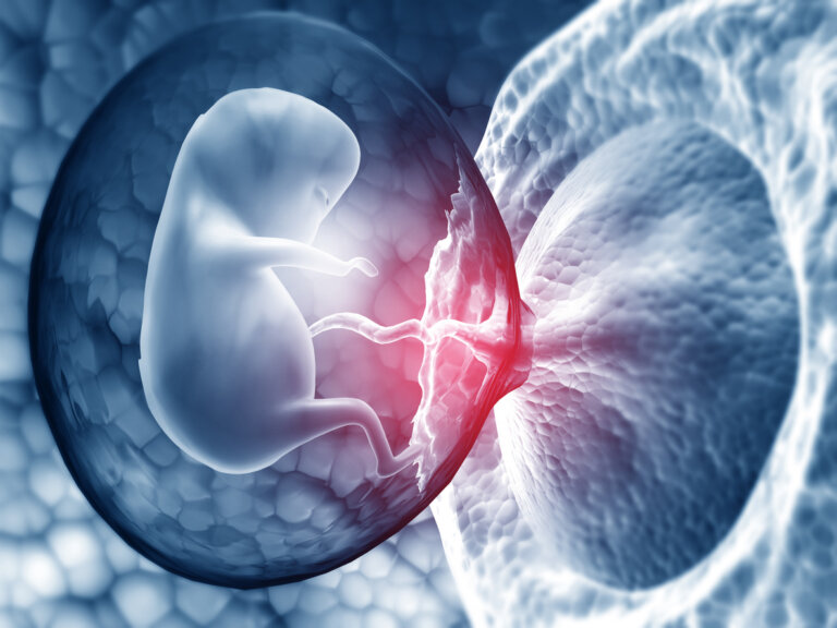 Placenta calcificada: lo que debes saber - Eres Mamá